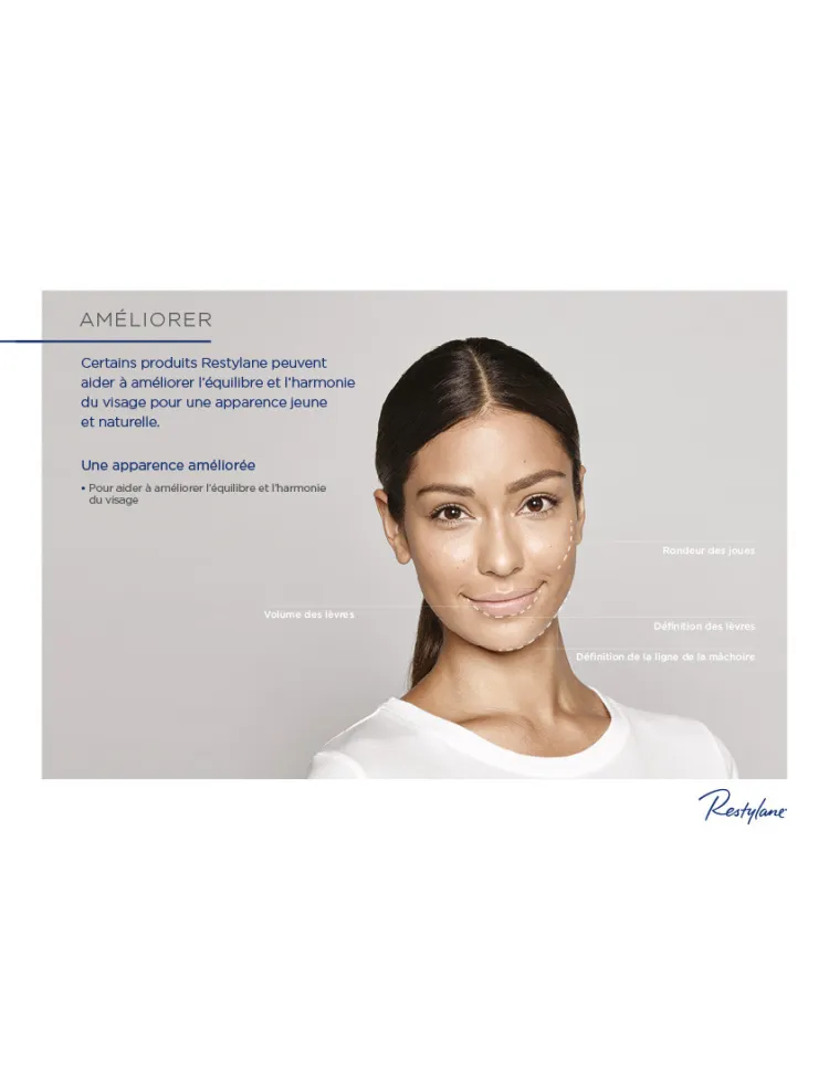 Restylane Classyc Lidocaine | French Filler